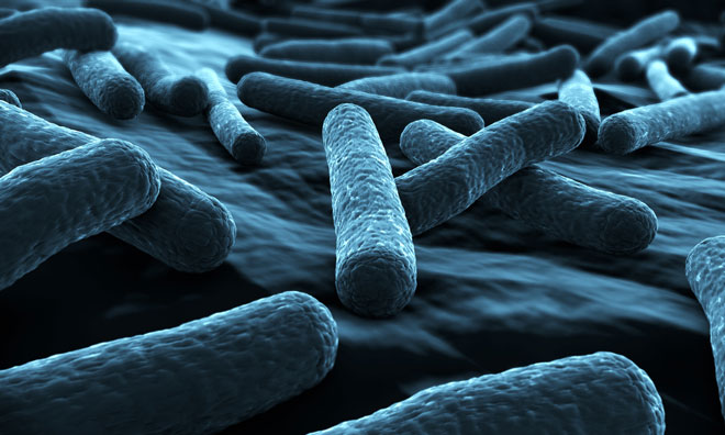 Food Standards Scotland investigating E. coli O157 outbreak as child dies